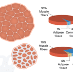 How to Fight Muscle Atrophy After Injury: A Personal Trainer’s Guide ...